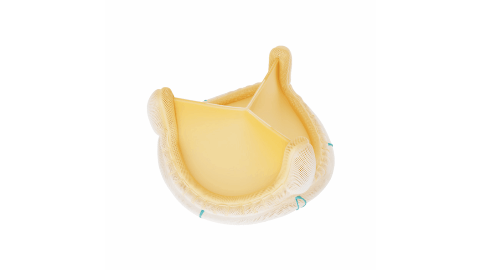 Medtronic launches Avalus Ultra™ surgical valves in India, enhancing ...